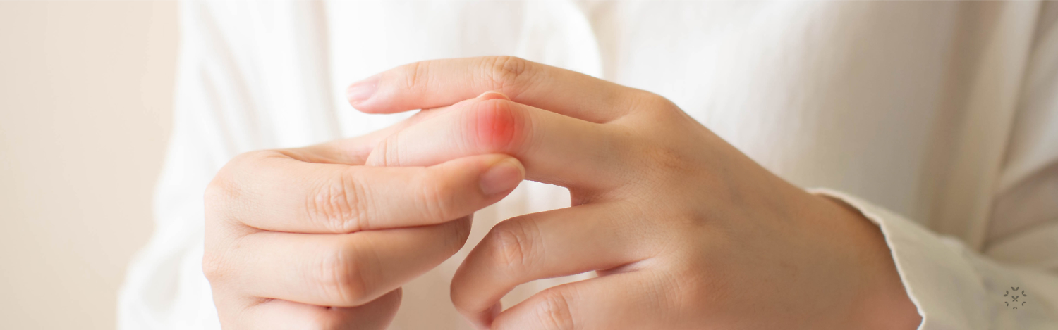 Scleroderma and Lupus - Kaleidoscope Fighting Lupus