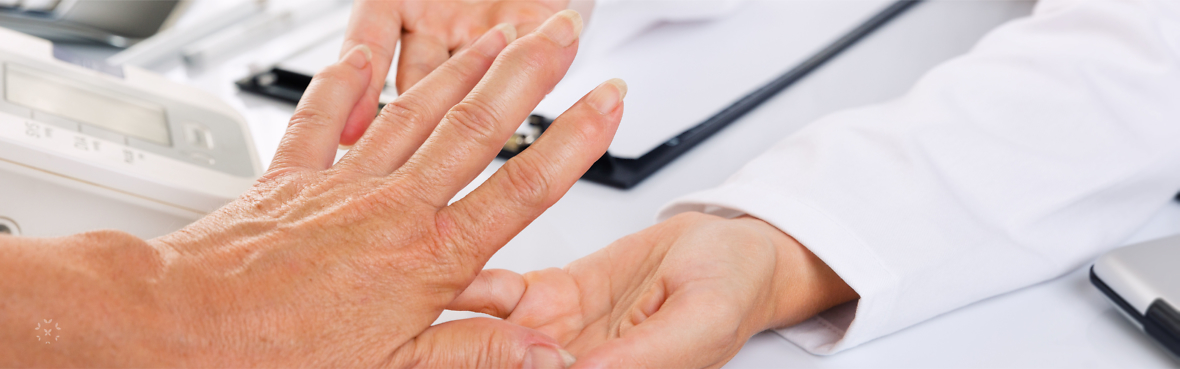 Mixed Connective Tissue Disease (MCTD) and Lupus - Kaleidoscope ...